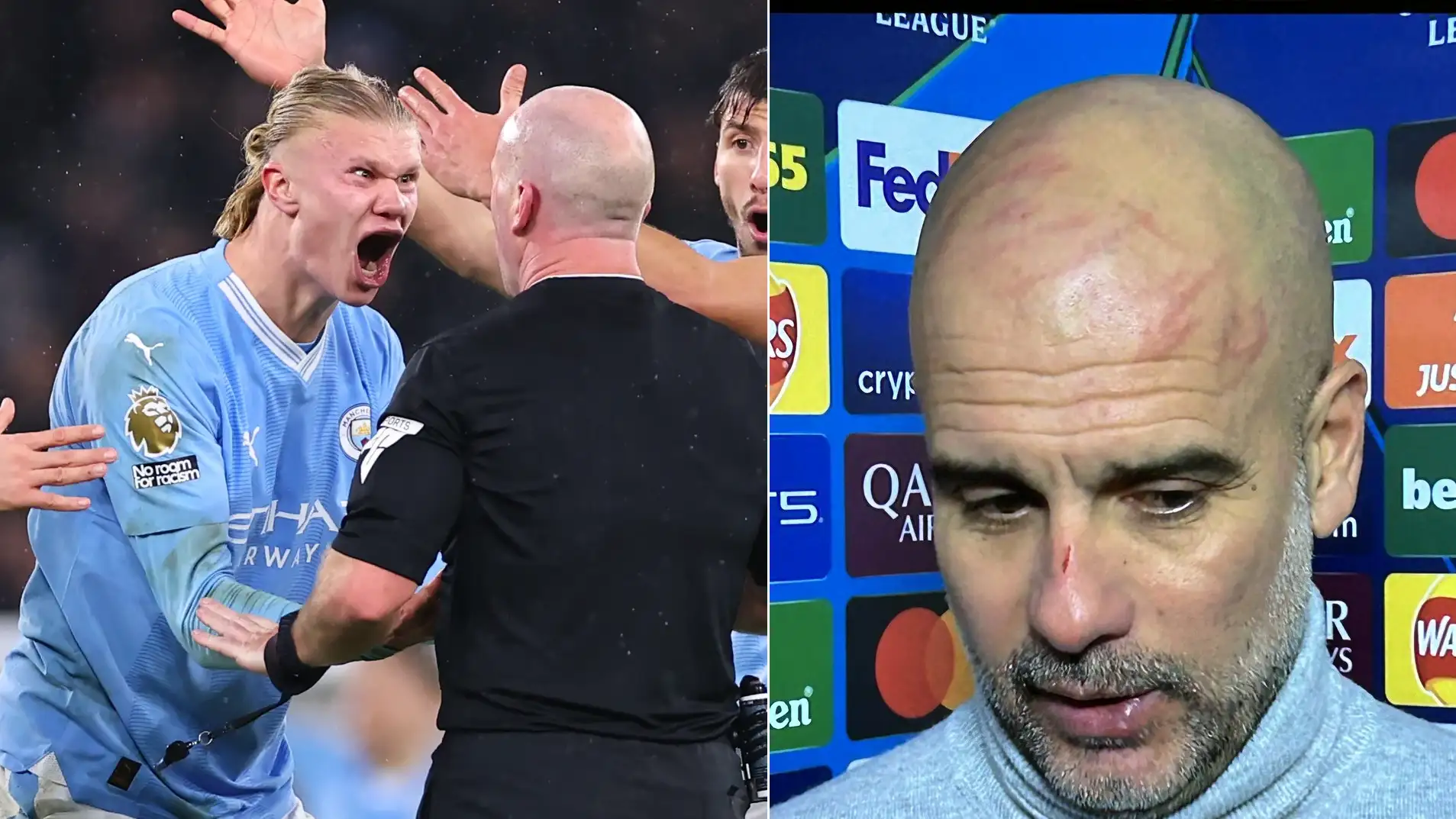 Pep GUARDIOLA con racha de SEIS partidos sin GANAR, se arañó el rostro ...